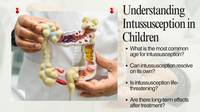 Understanding Intussusception in Children